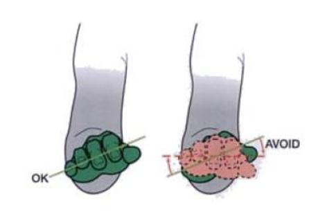 What is the right position for the dentist when working with patients ...