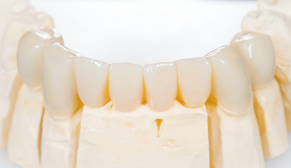 Different Types Of Dentures and What is Best For You | Mill Bay Dental ...