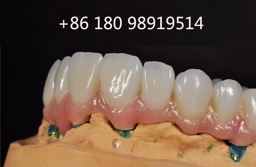 HOW TO FIND A RELIABLE DENTAL LABORATORY | Shenzhen MYY Dental | Dentagama