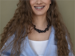The Complete Guide to Power Chain Braces | Thurman Orthodontics Braces ...