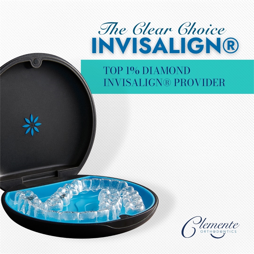 Invisalign | Dentagama