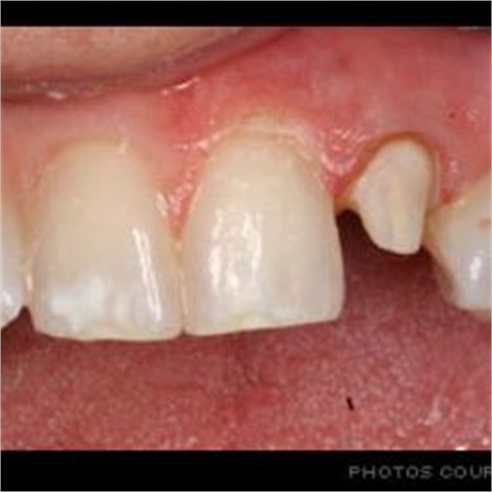 Invisaline | Dentagama