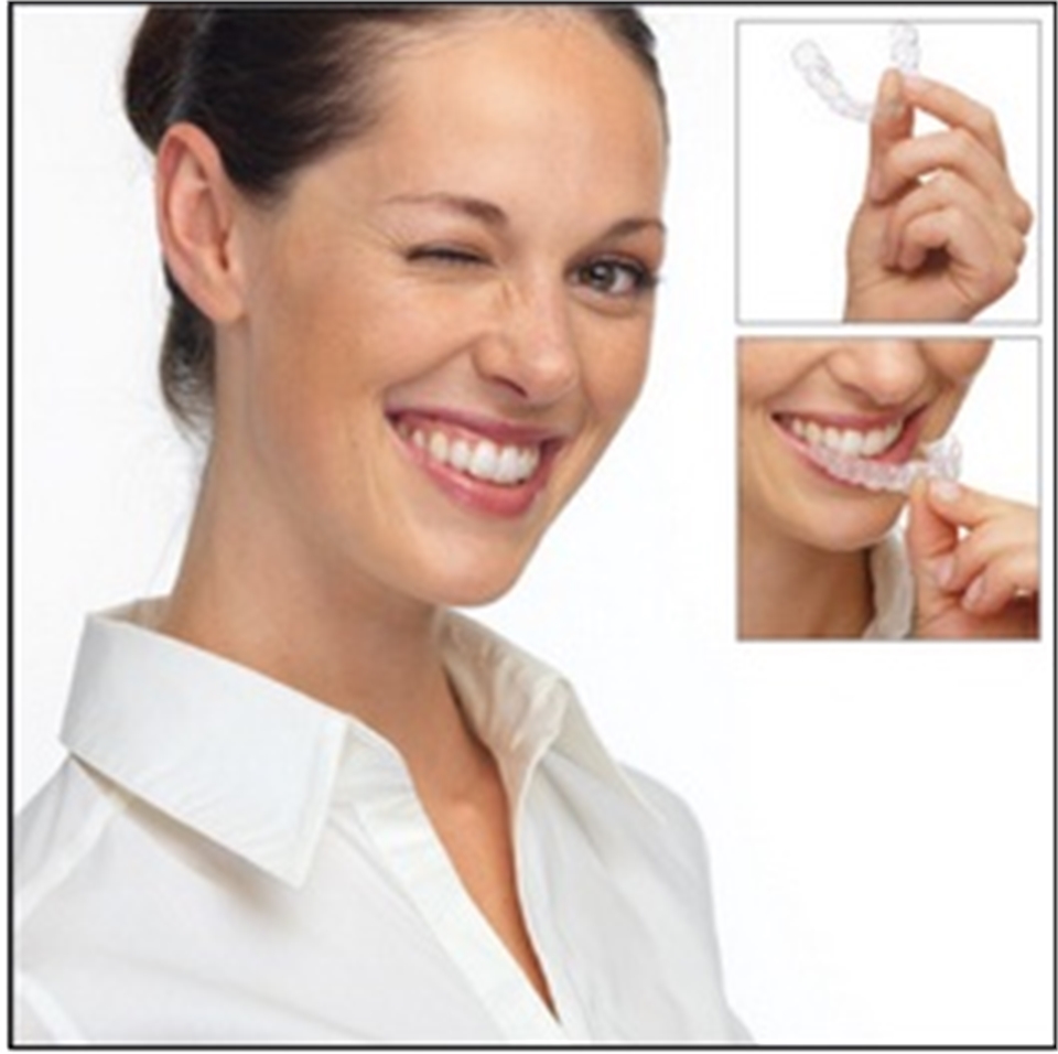 Invisalign | Dentagama